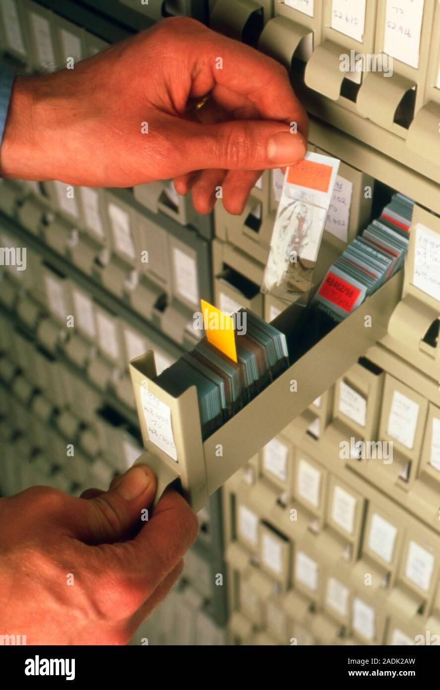 Cervical smear slides. Stained cervical smear slides being filed in a ...
