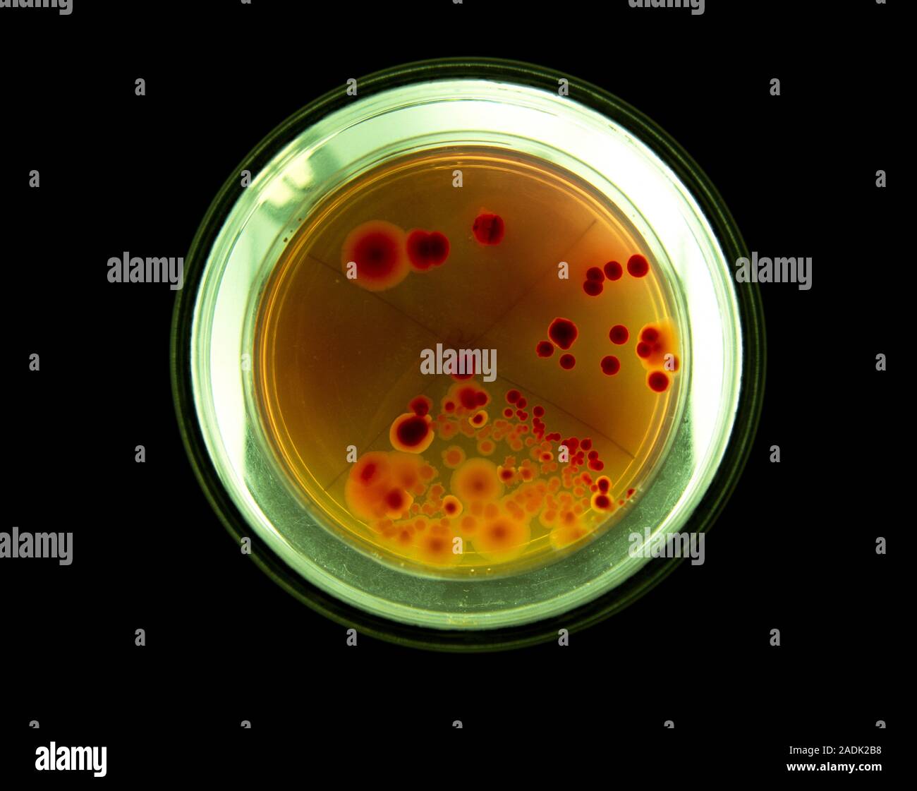 Bacterial culture. Bacterial colonies growing on MacConkey's agar in a ...