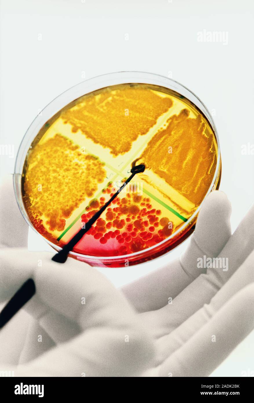 Bacterial cultures. Technician using a sterile rod to sample a colony ...