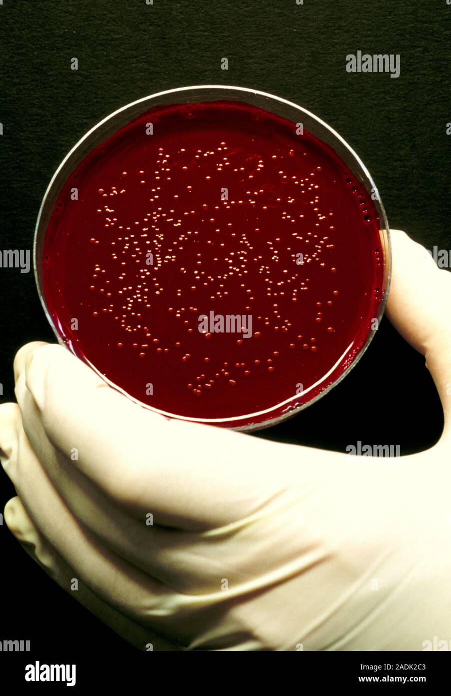 Bacterial colonies cultured on blood agar growth medium in a petri dish ...