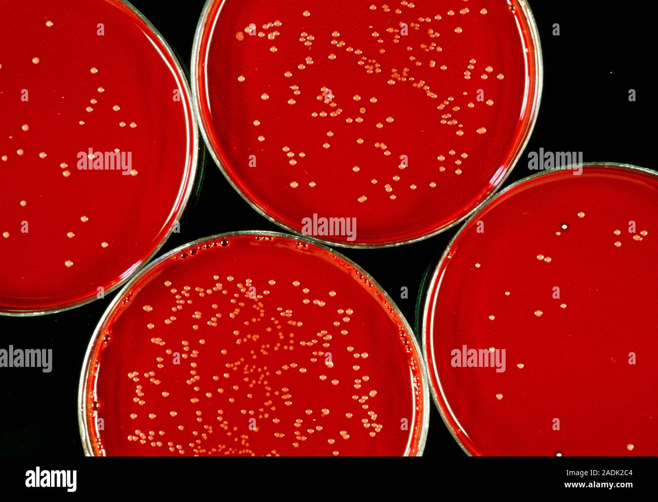 Bacterial colonies cultured on blood agar growth medium in petri dishes ...