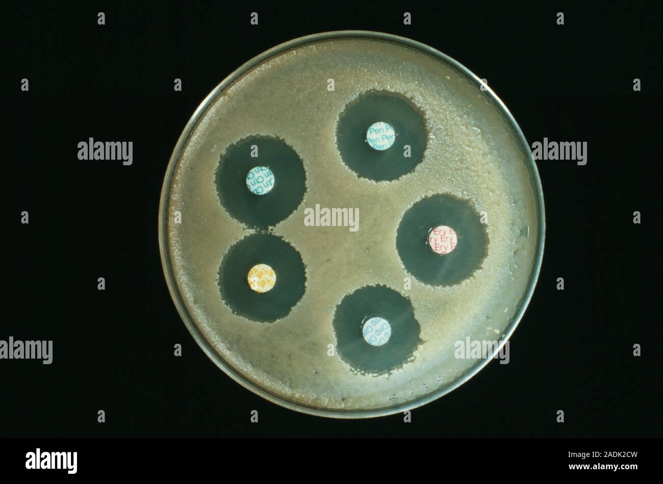 Anthrax antibiotics research. Antibiotic drugs (discs) being tested on ...