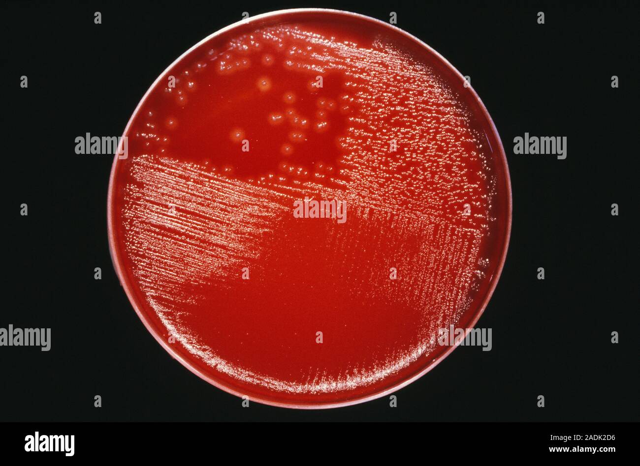 Clostridium Perfringens Colony