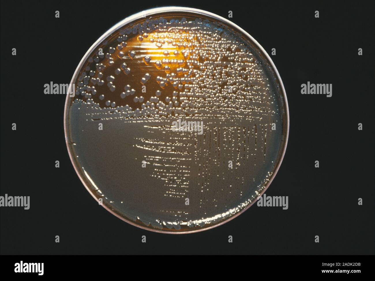 E. coli bacteria (Escherichia coli) colonies being cultured on an agar ...