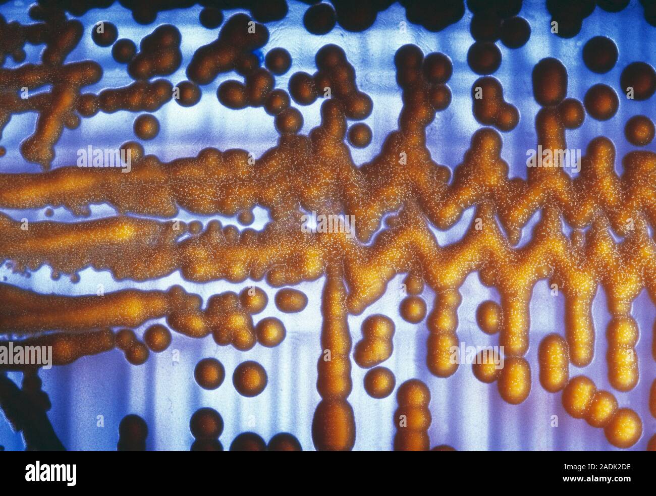 E. coli bacteria. Close-up of Escherichia coli colonies (brown) being ...