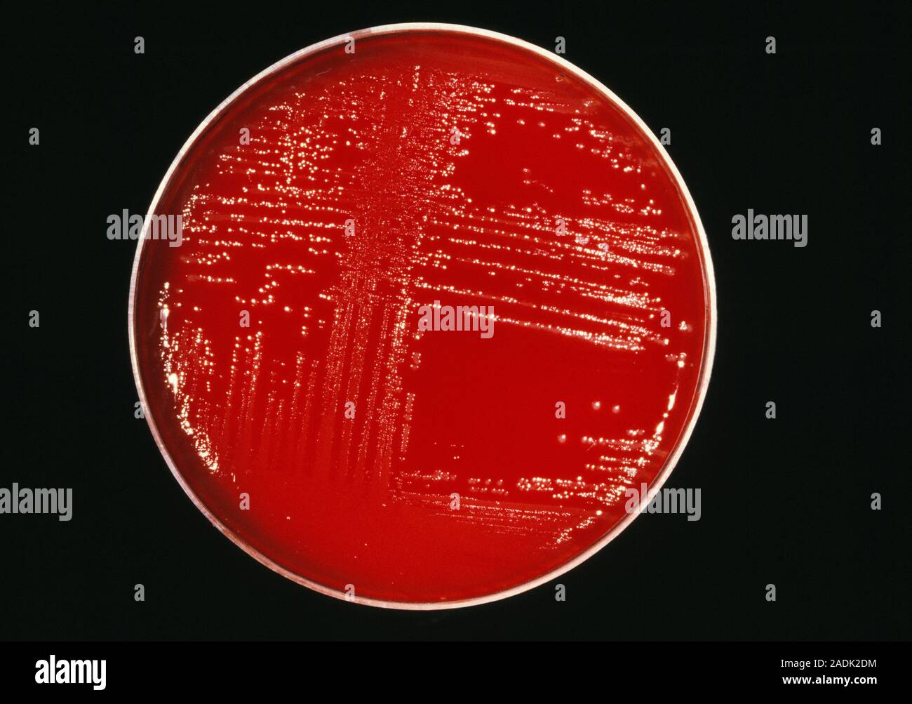 Listeria bacteria (Listeria monocytogenes) colonies (white) being ...