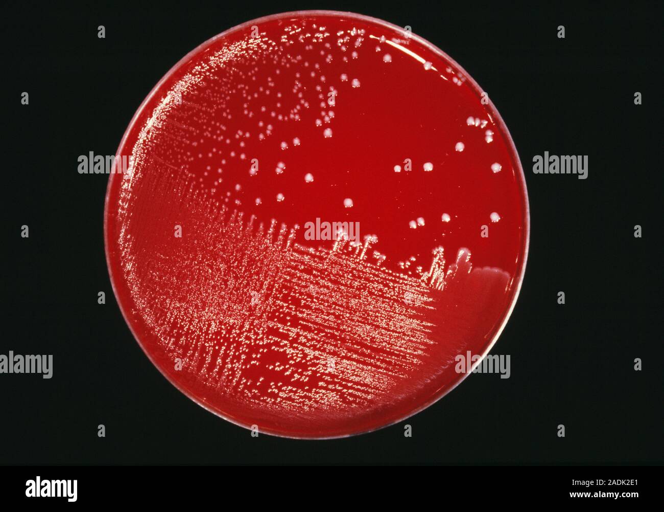 Pasteurella Multocida