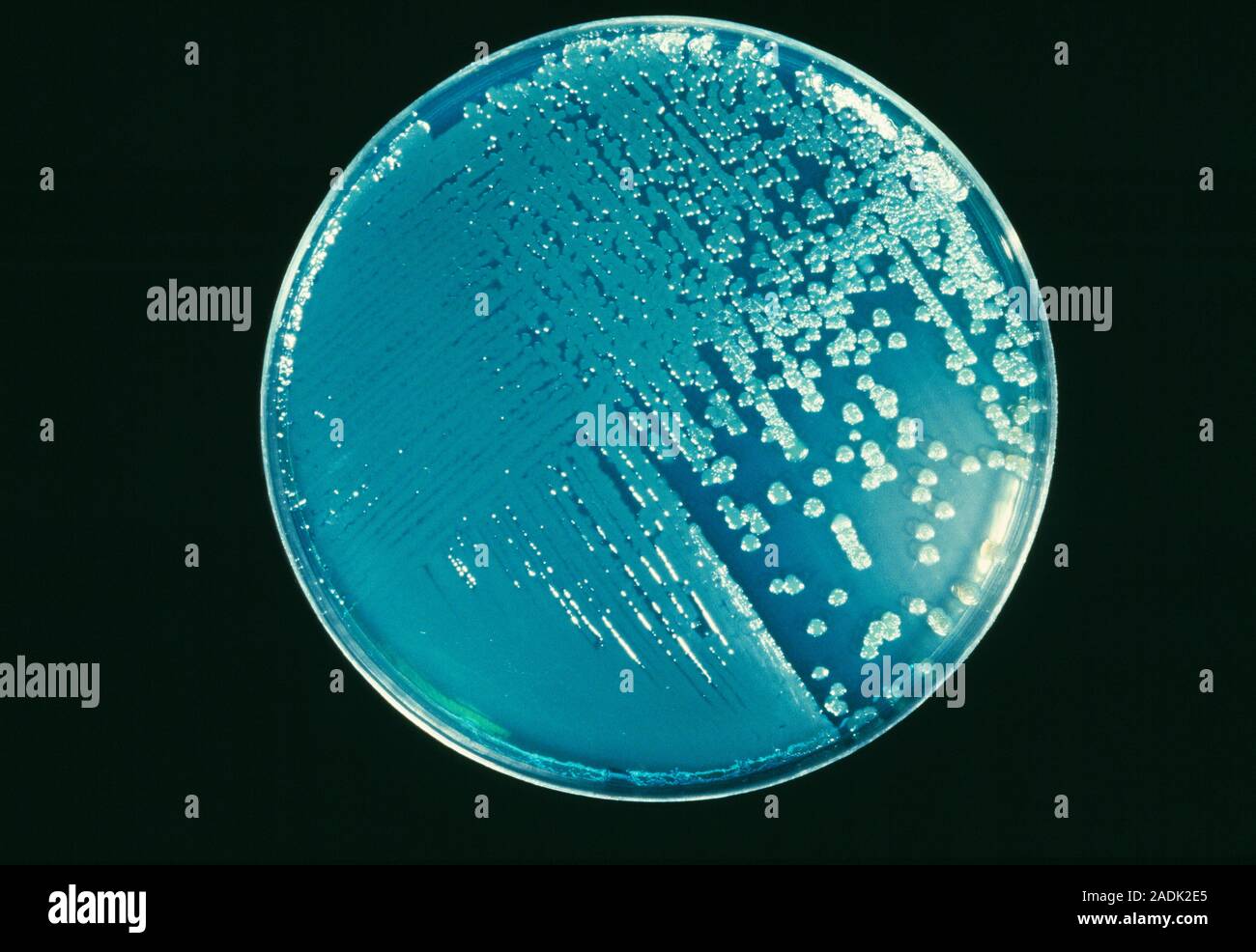 Pseudomonas bacteria (Pseudomonas aeruginosa) colonies being cultured ...