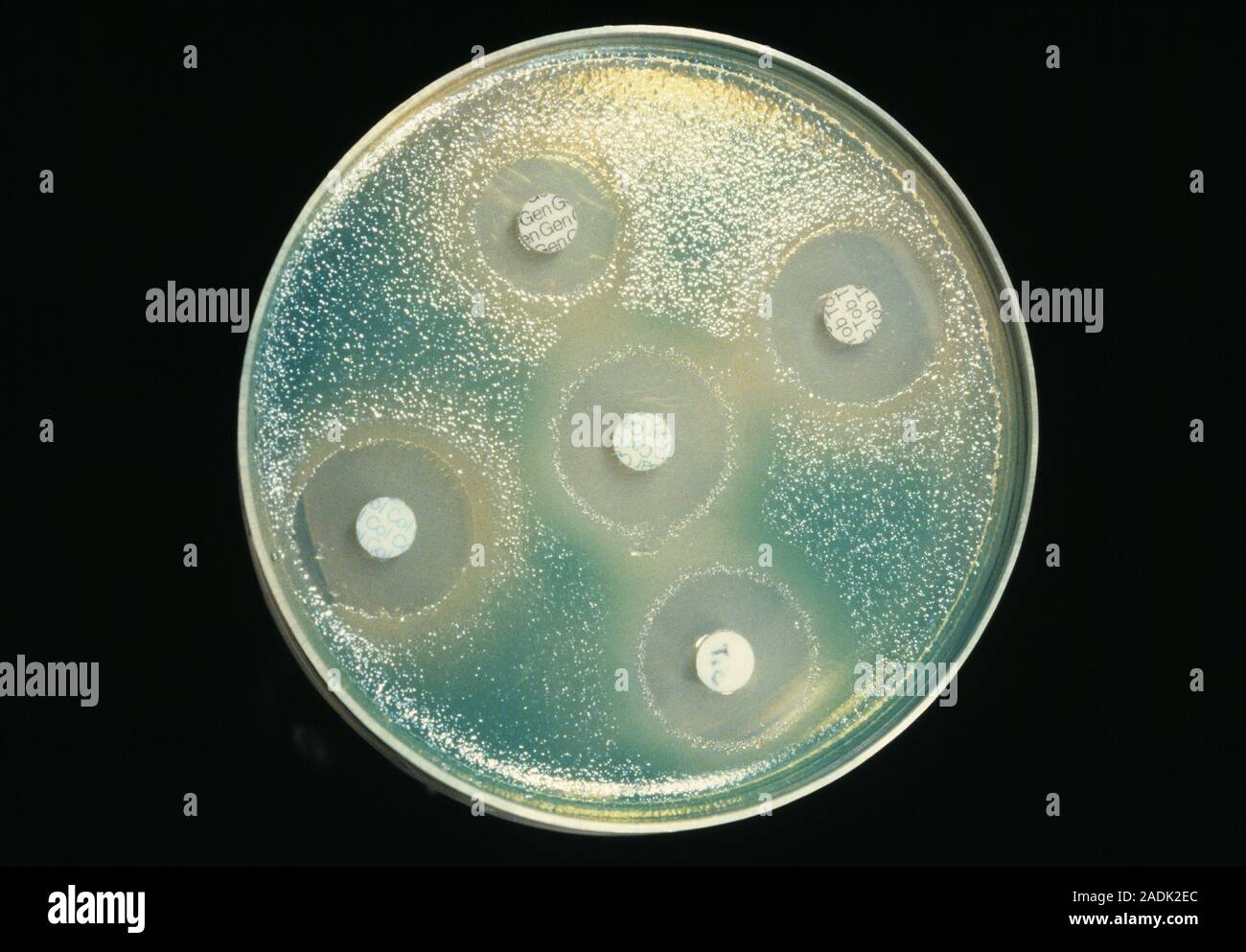 Antibiotics research. Antibiotic drugs (discs) being tested on colonies ...