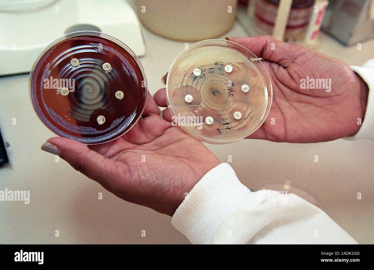 Antibiotics research. Culture plates testing for antibiotic resistance ...