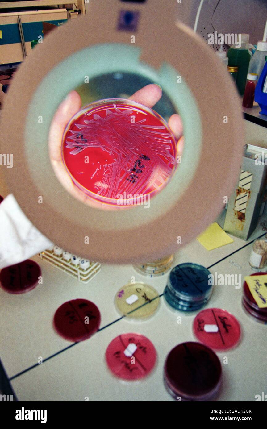 Bacteria research. Agar plate of cultured methicillin-resistant ...