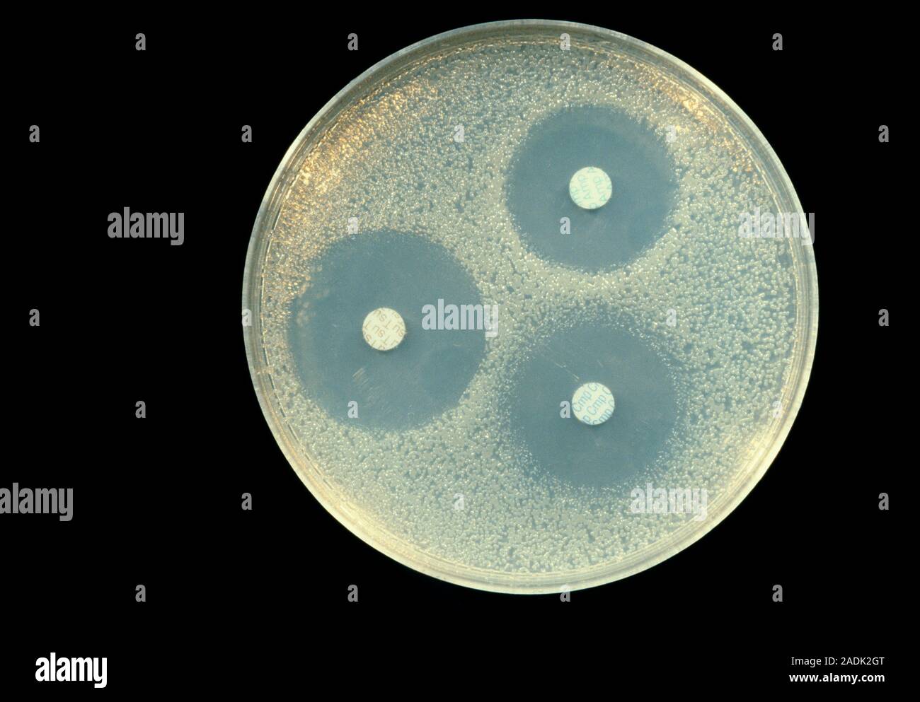 Antibiotics Research Three Different Types Of Antibiotic Being Tested On Colonies Of Typhoid
