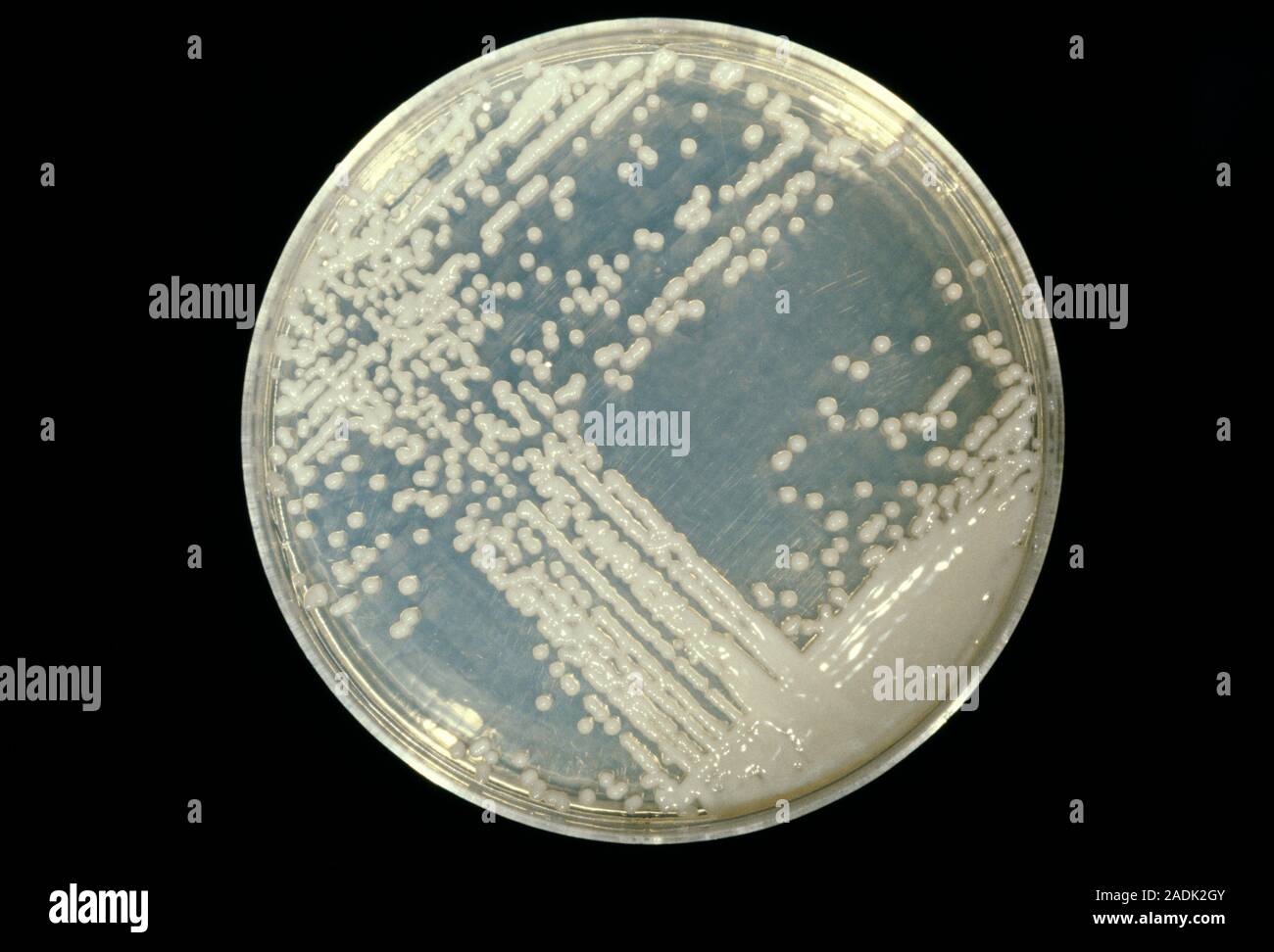 Cryptococcus fungus. Culture of Cryptococcus neoformans fungus growing ...