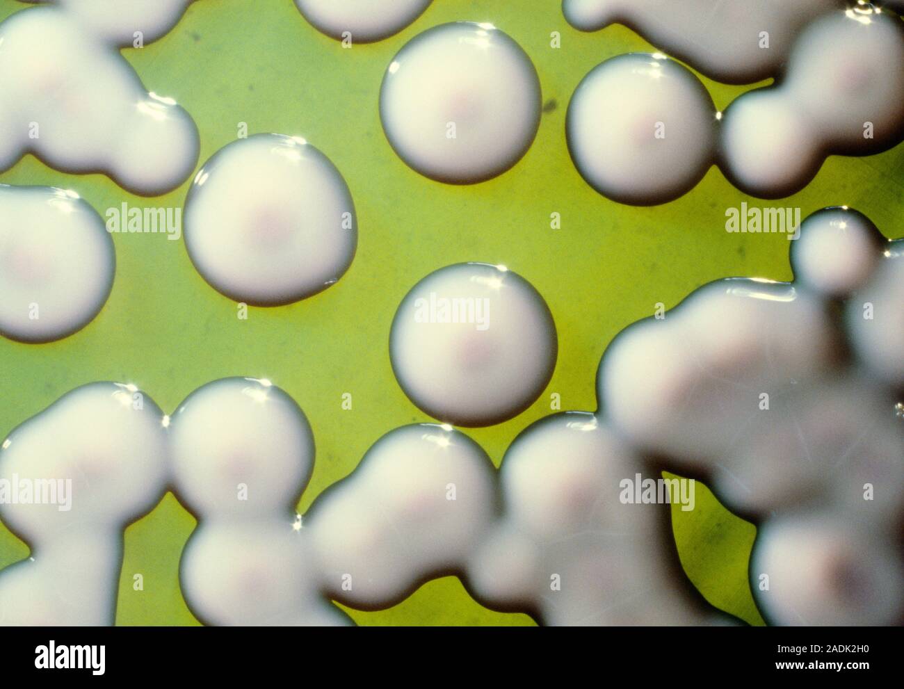 Cultured typhoid bacteria. Close-up of typhoid bacteria (Salmonella ...