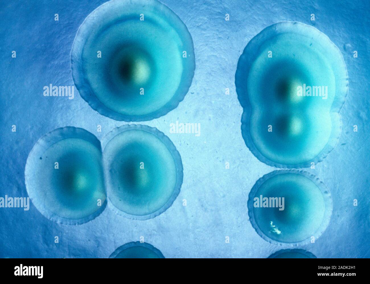 Cultured typhoid bacteria. Close-up of typhoid bacteria (Salmonella ...
