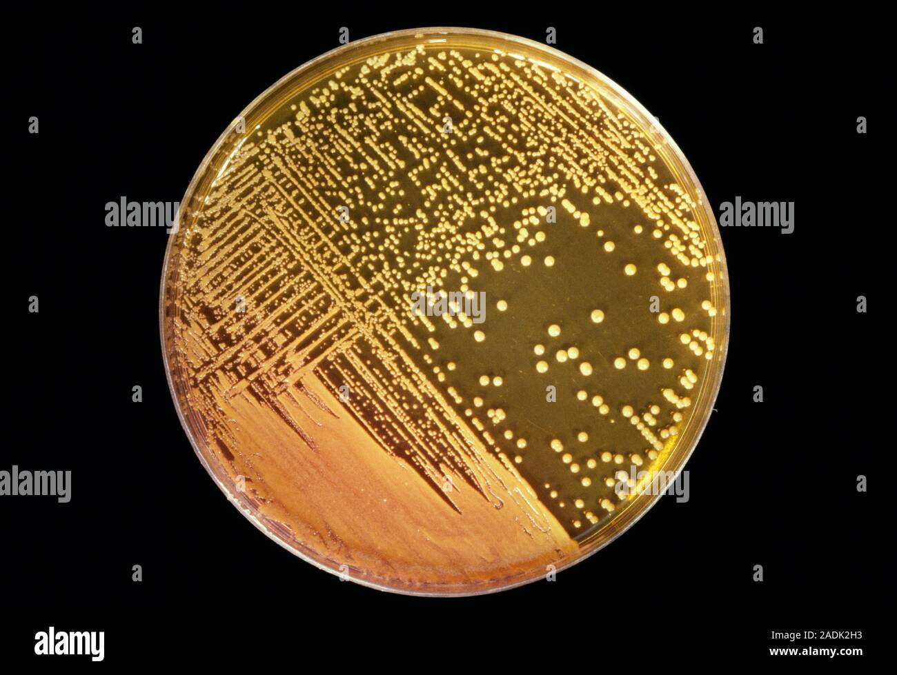 Culture Plate Of Staphylococcus Aureus at Alexander Jarrett blog