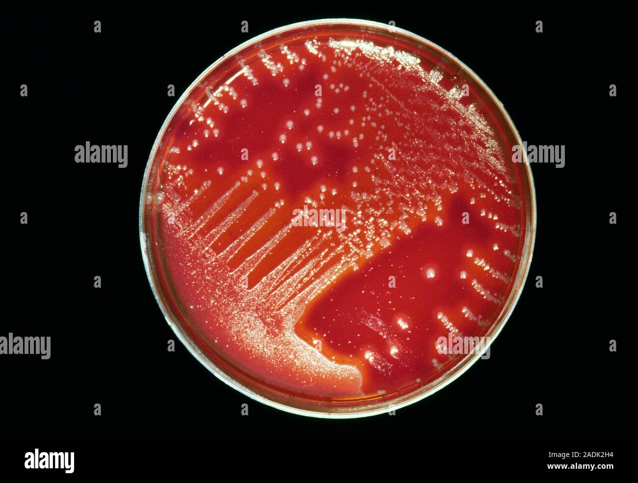 Streptococcus Bacteria Colonies Of Streptococcus Pyogenes A Gram Positive Bacterium Growing