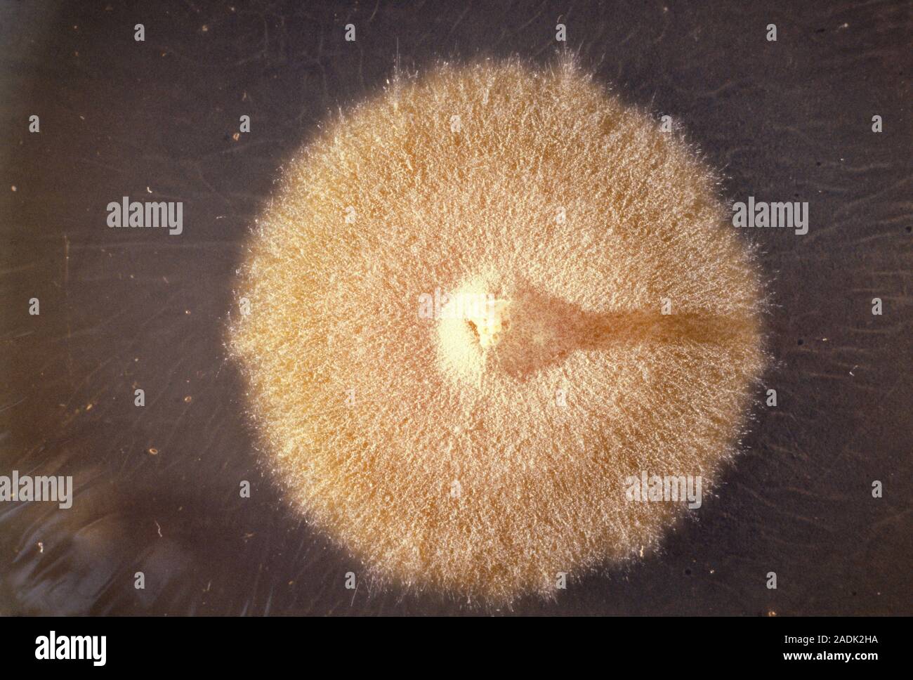 Dermatophyte fungus. Cultured colony of the dermatophyte fungus ...
