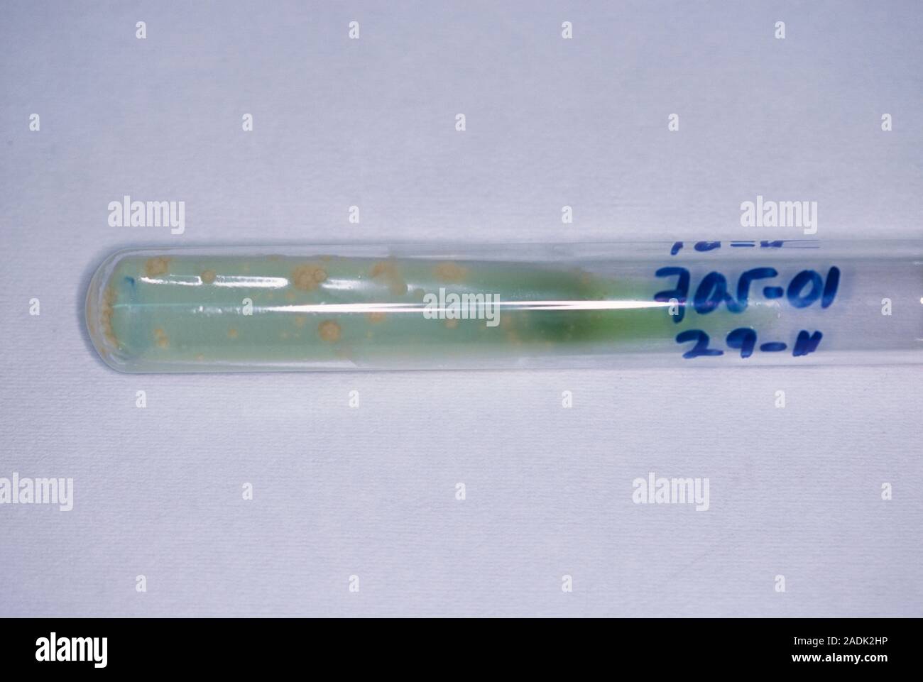 Tuberculosis research. Test tube being used to culture tuberculosis (TB ...