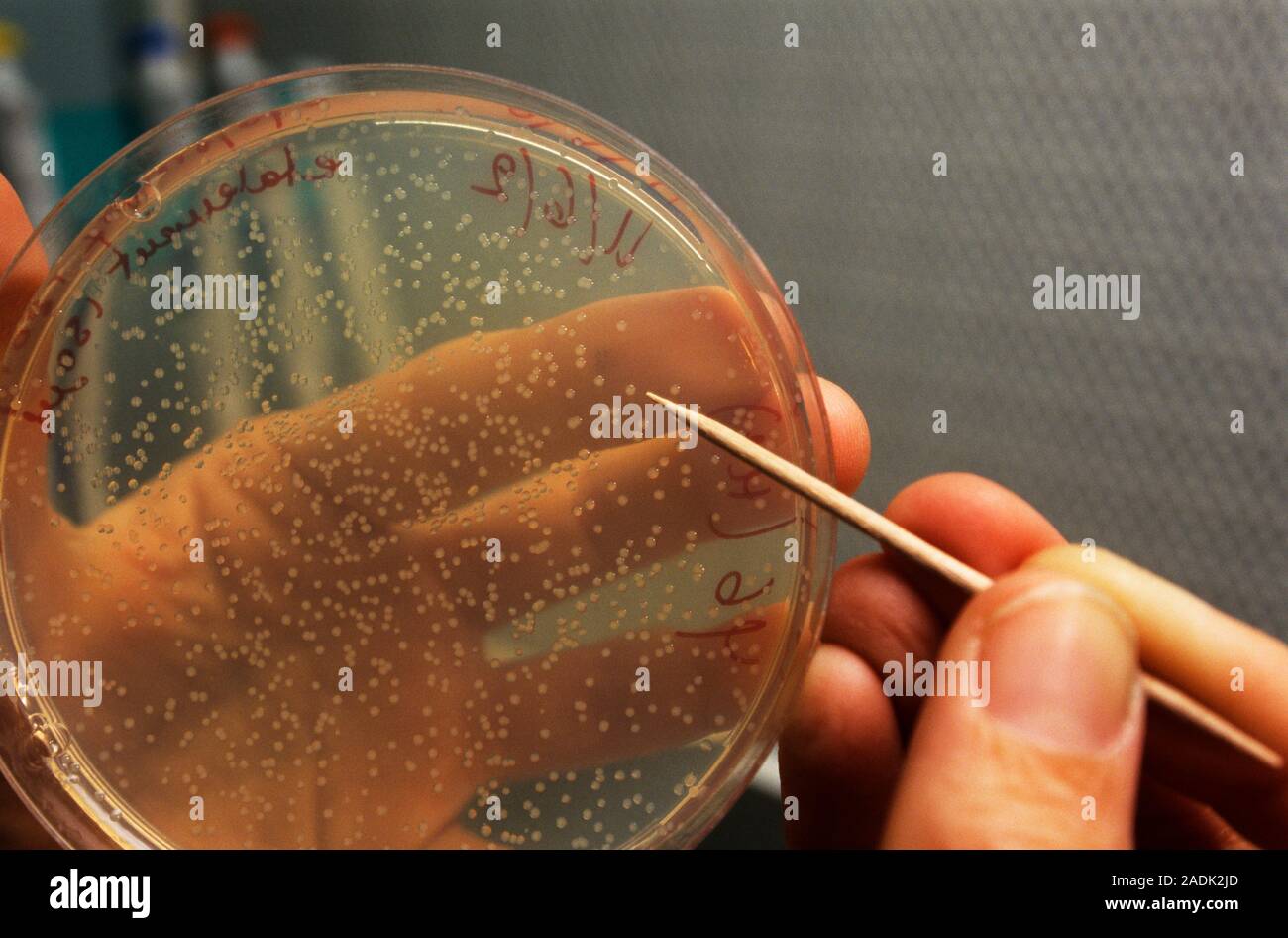 Bacterial research. Counting of bacterial colonies (spots) on a petri dish. The petri dish ...