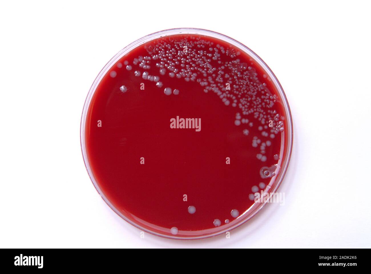 Listeria bacterial culture (white) growing in a petri dish on agar (red ...