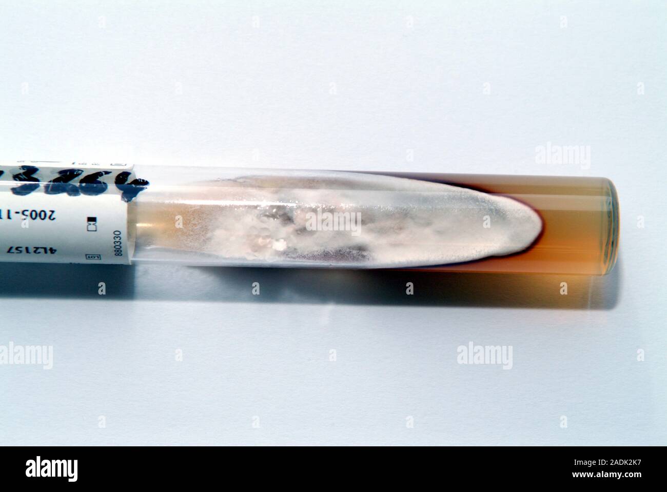 Dermatophyte fungal culture (white) in a tube. The fungus is growing in ...