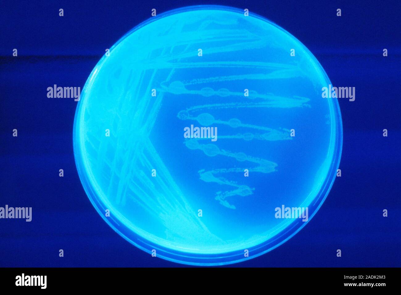 Bacterial culture in a petri dish under ultraviolet light Stock Photo ...