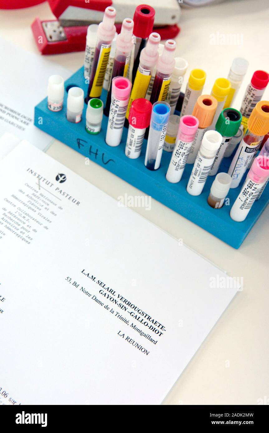 Viral research. Samples ready for analysis at the National Reference ...