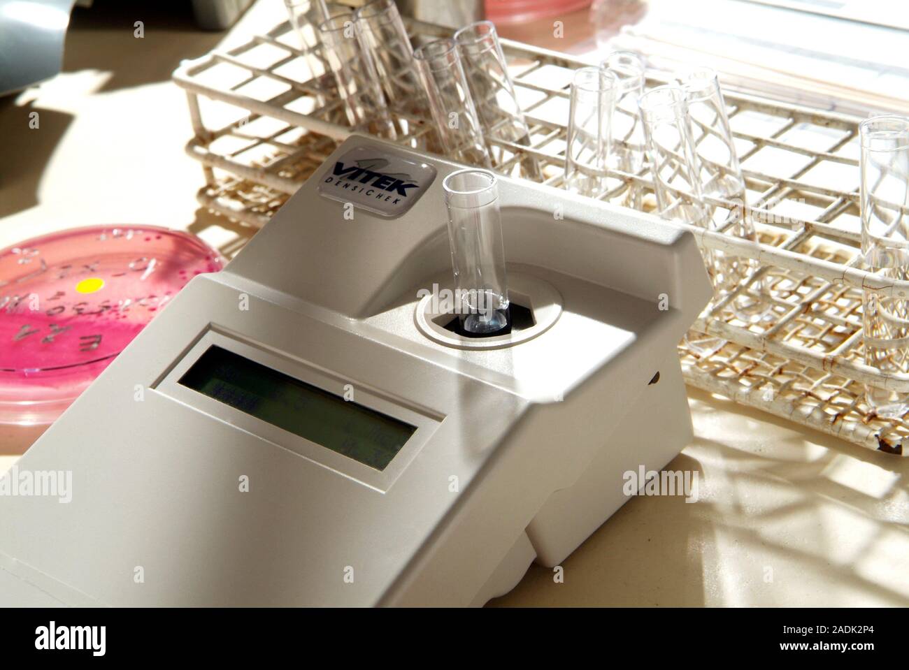 Preparing bacterial suspension. Densitometer machine being used to ...