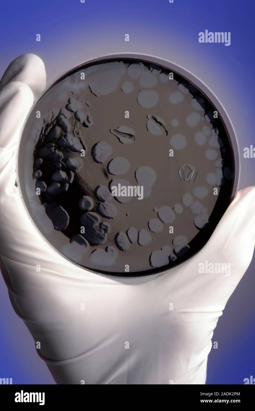 MODEL RELEASED. Legionella bacteria culture. Microbiologist holding a ...