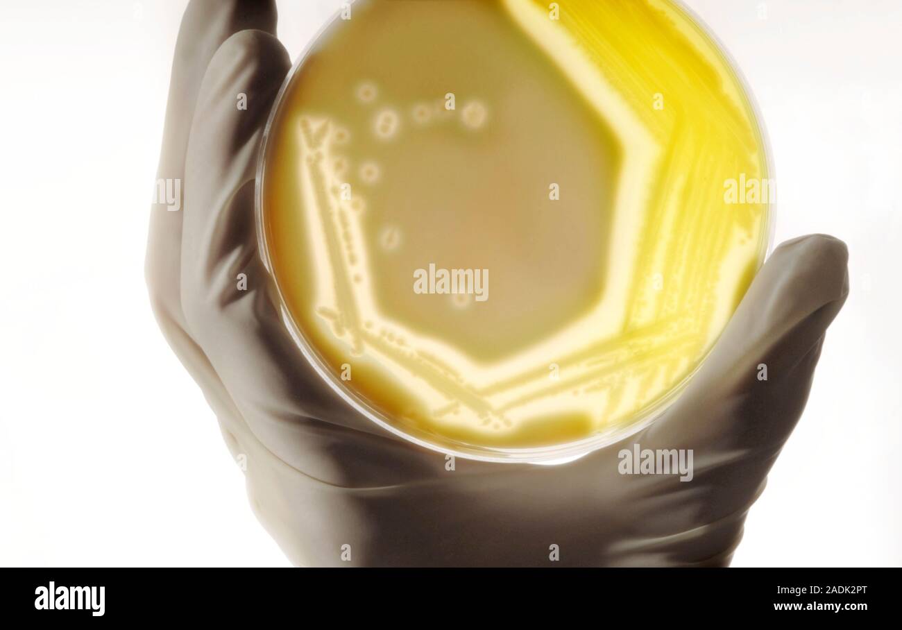 MODEL RELEASED. Pseudomonas culture. Microbiologist holding a petri ...