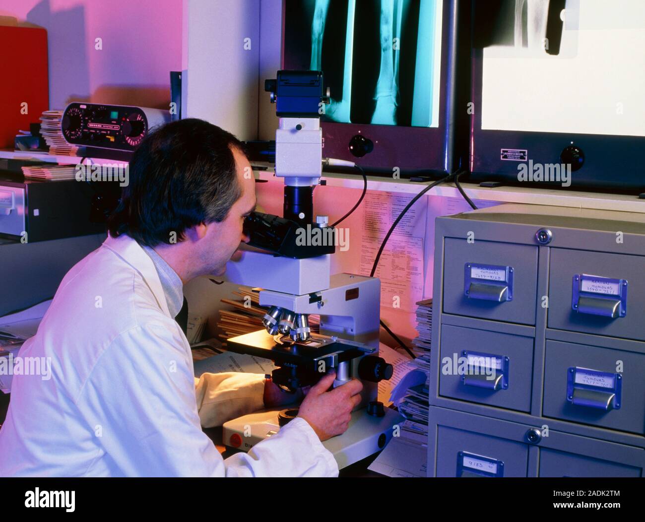 Hospital pathologist using a light microscope to examine a bone biopsy ...