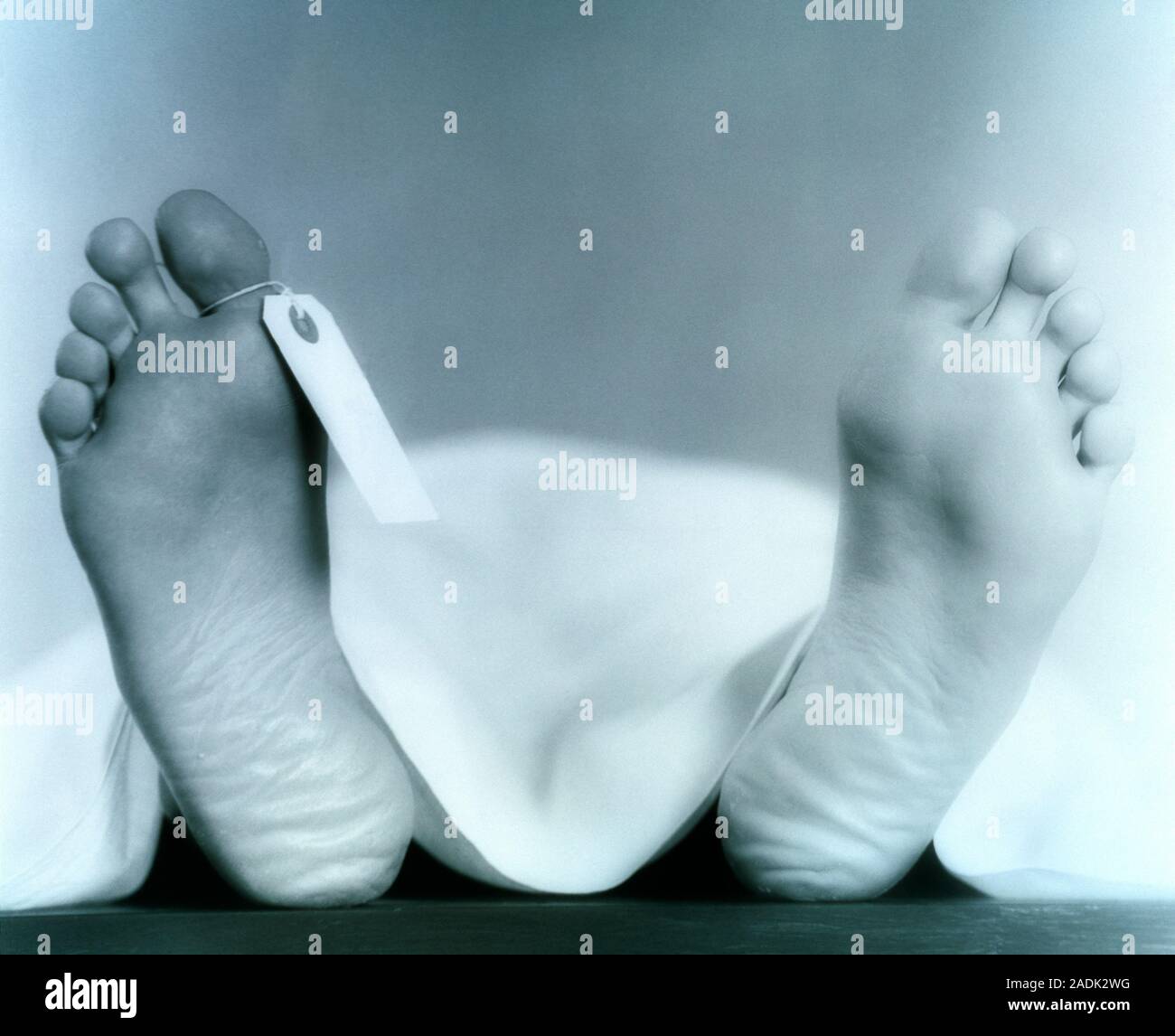 Cadaver's feet. Identification tag tied on one of the feet of a cadaver ...