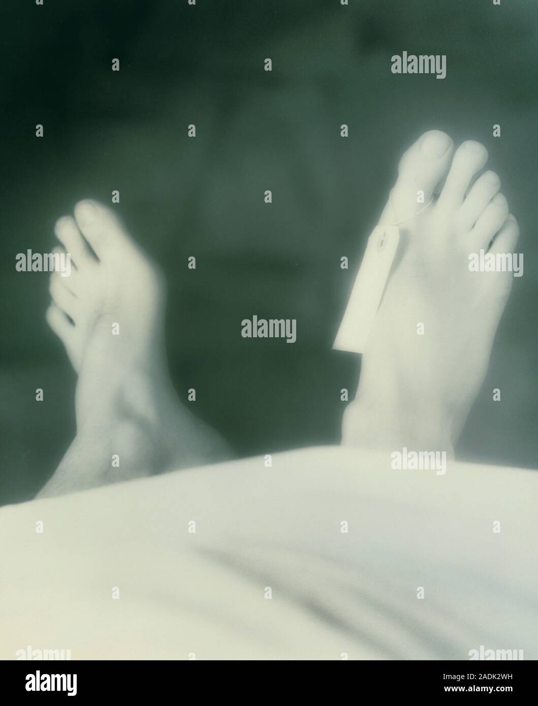 Cadaver's feet. Identification tag tied on one of the feet of a cadaver ...