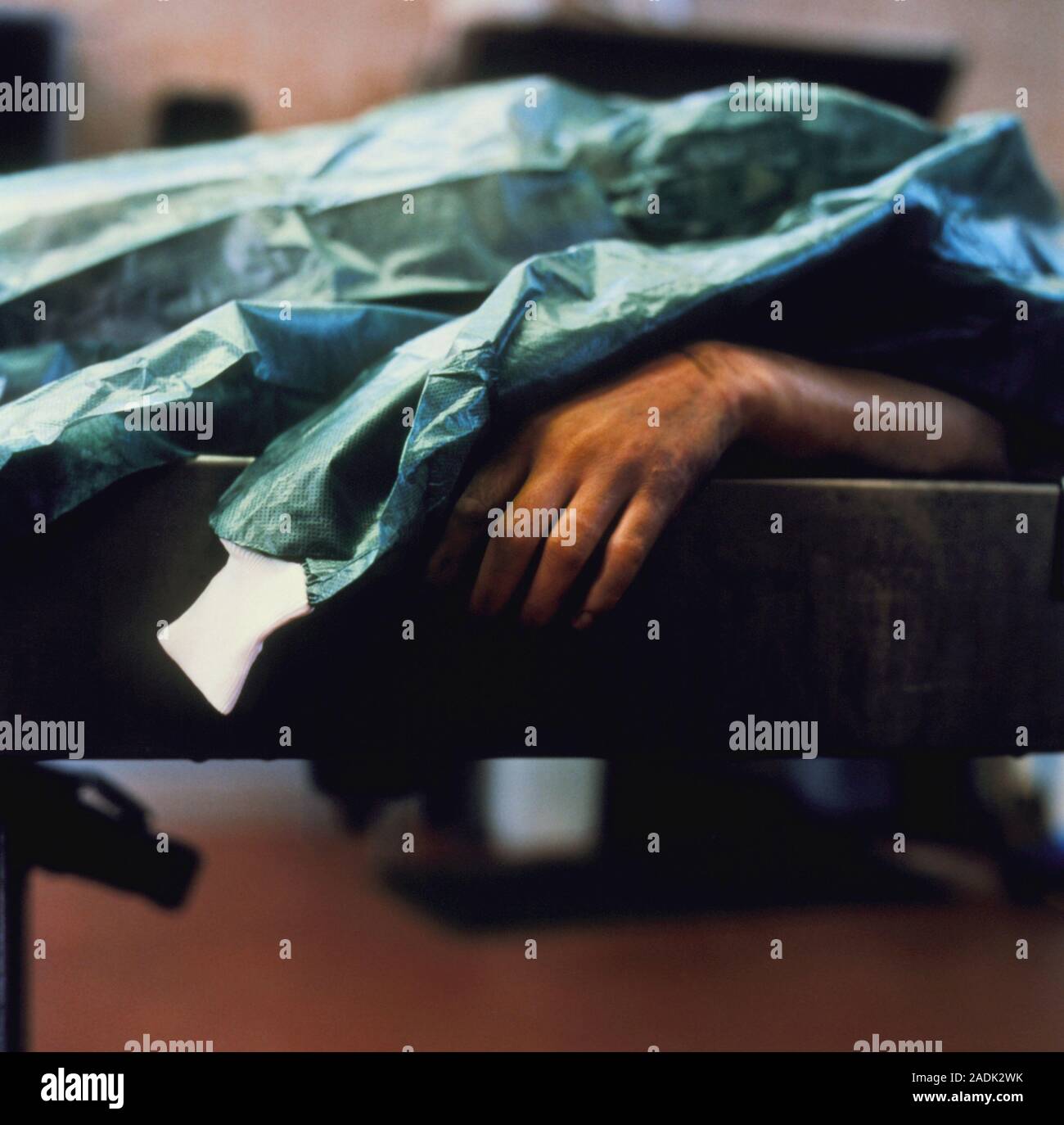 Autopsy examination. Hand of the corpse of a 20 year old woman during ...