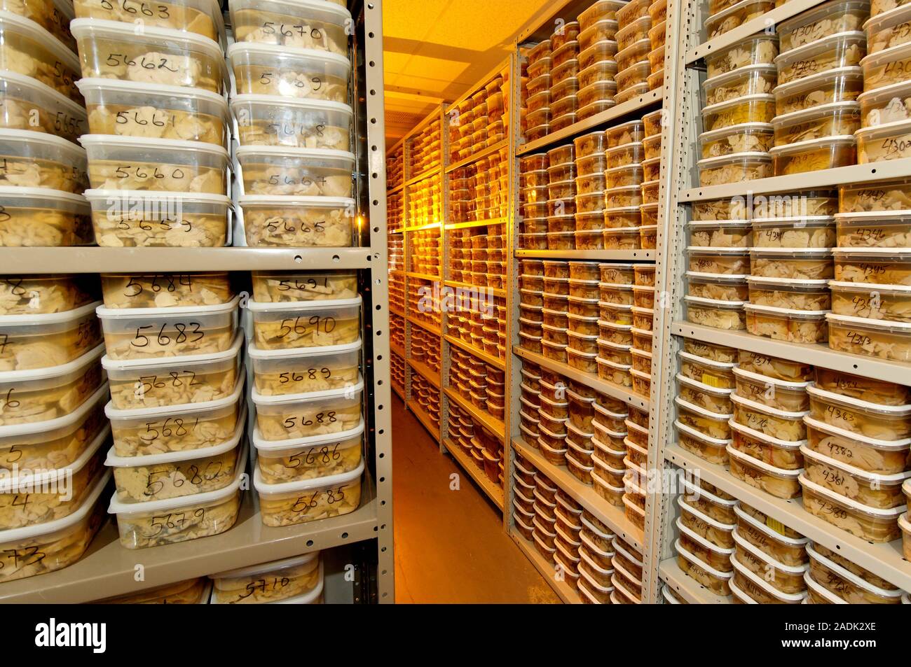 Brain bank. Human brain sections stored at the Harvard Brain and Tissue ...