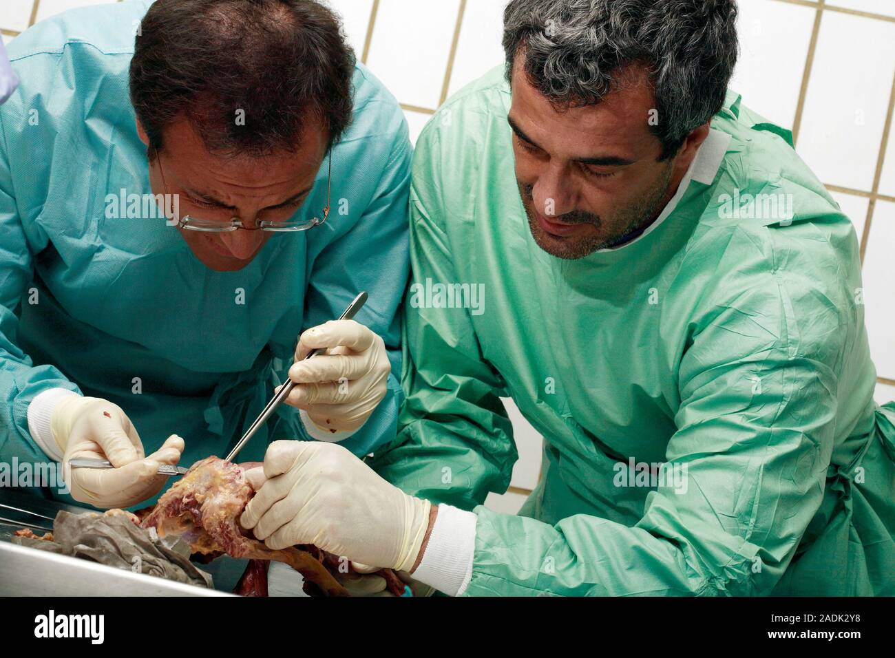 MODEL RELEASED. Autopsy examination of a shoulder. Pathologists ...