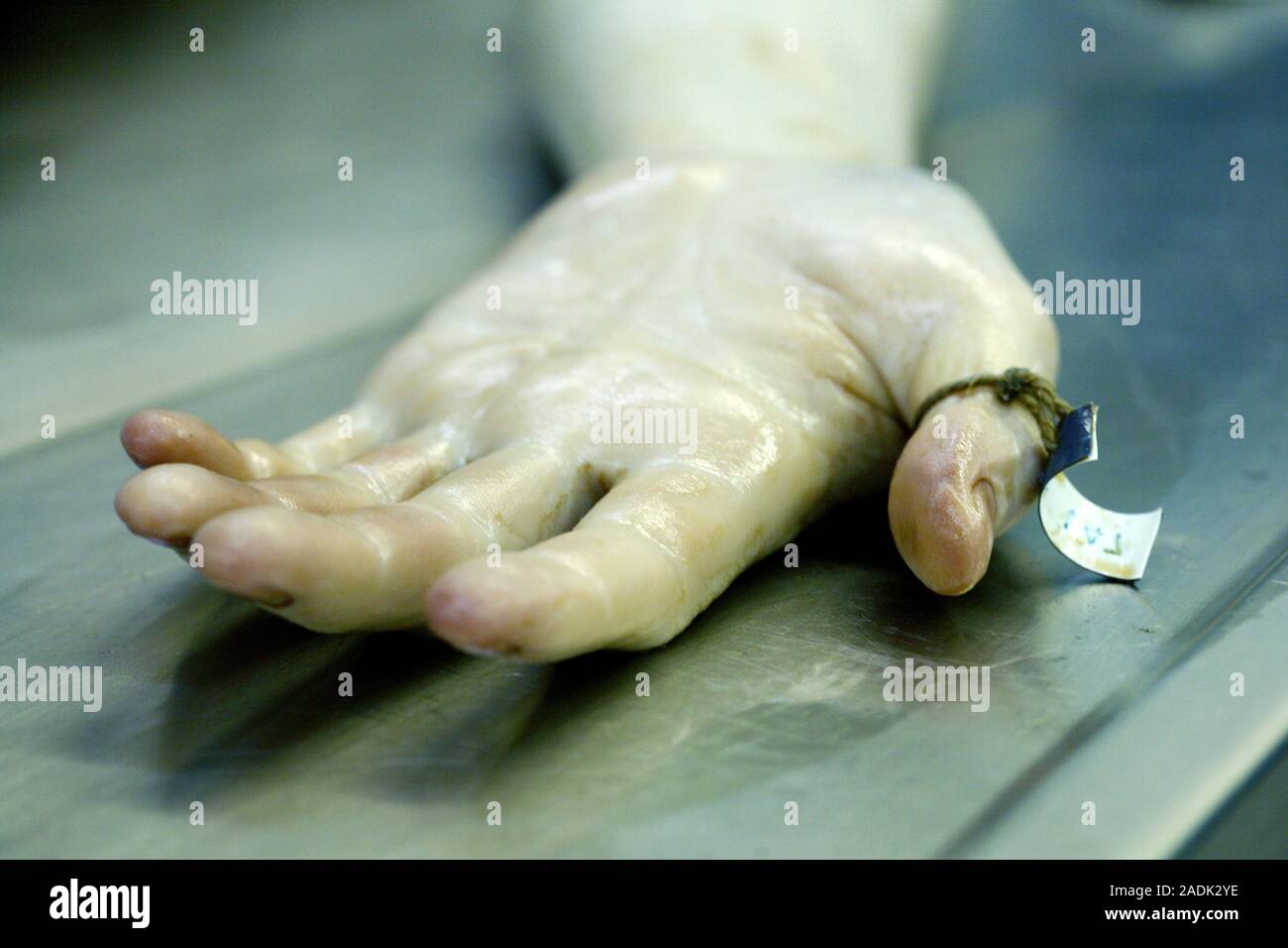 MODEL RELEASED. Hand of a corpse in a mortuary. This corpse is ...