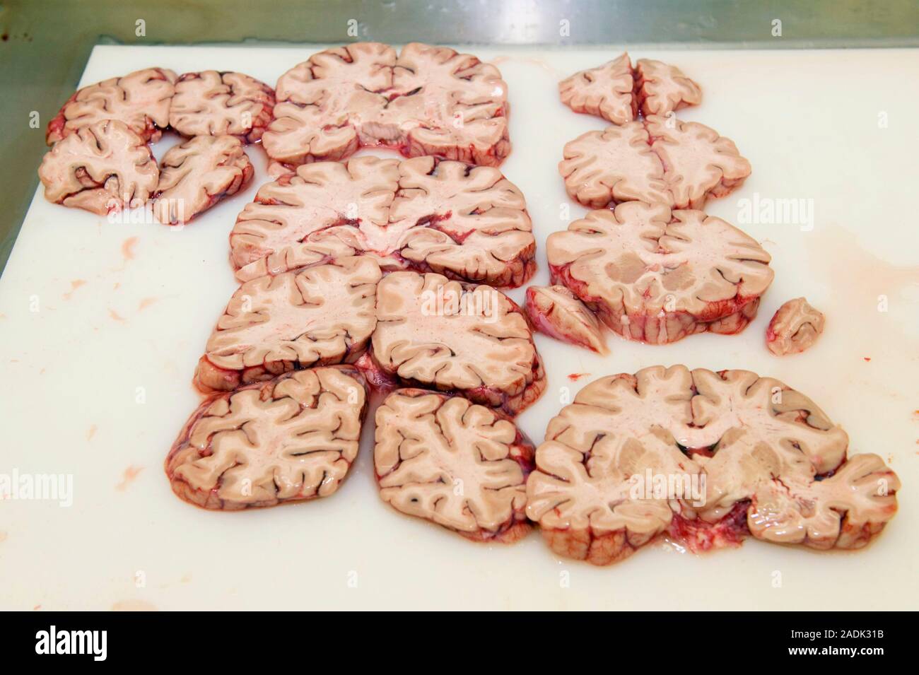 Brain, post-mortem. The brain, located in the head, is the central ...
