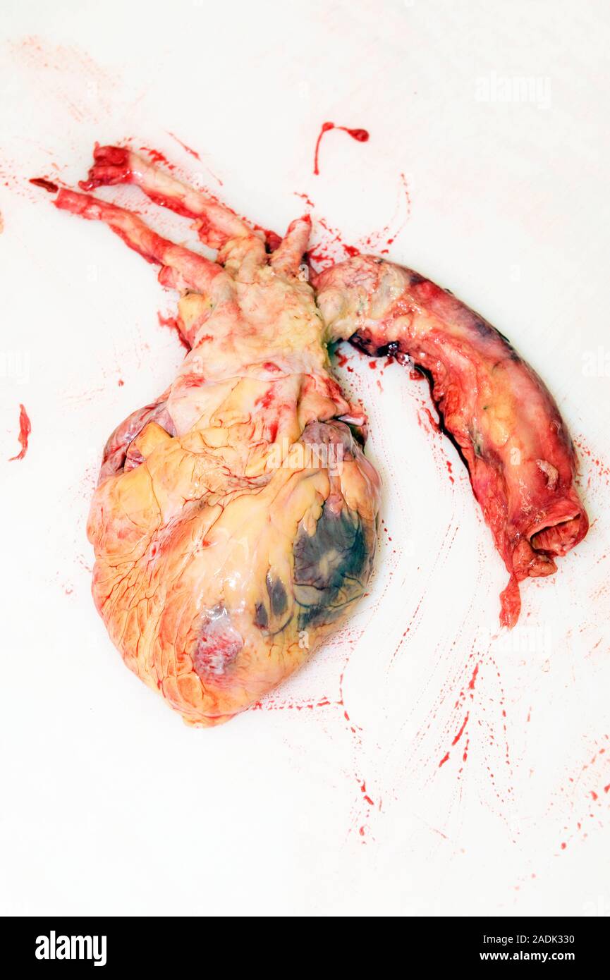 Heart, post-mortem. The heart is the muscular organ that pumps blood ...