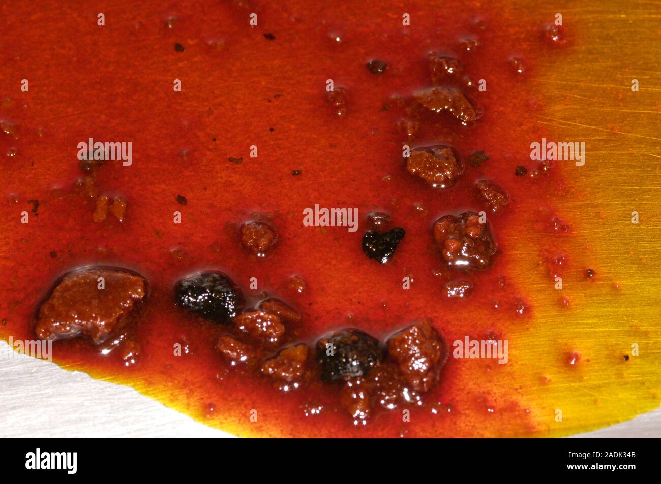 Bile, post-mortem. Bile is a fluid, produced in the liver, and ...