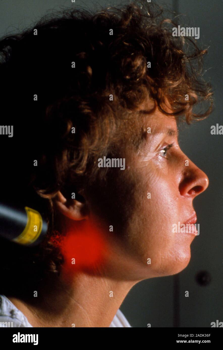 Laser therapy. A woman patient receives low-level laser therapy to her ...