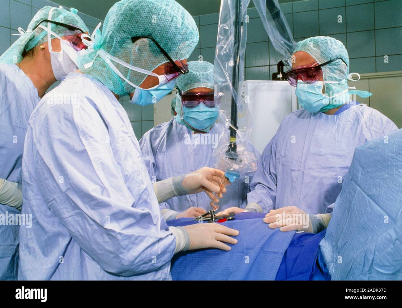 Laser heart surgery. Surgical team using a laser (down centre) during ...