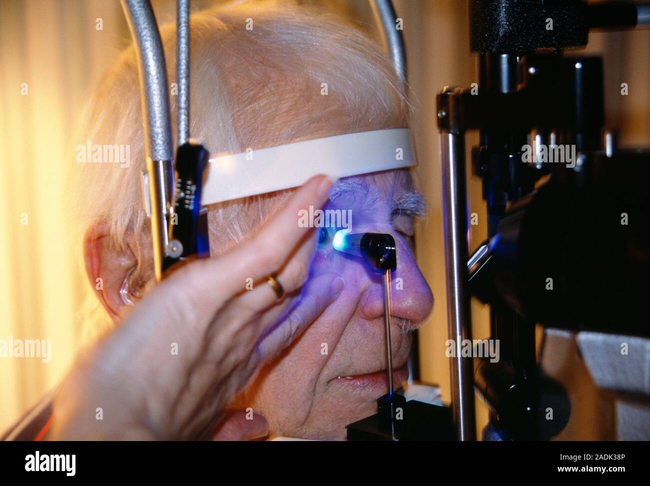 Laser eye surgery. Elderly man having a blue argon laser shone into his ...