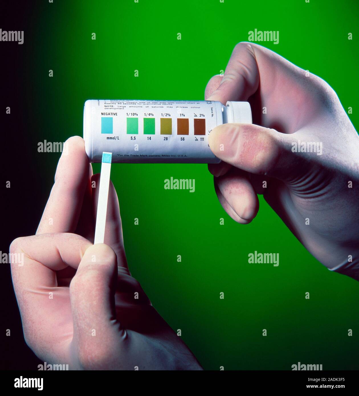 Glucose Urine Test General Practice Doctors Gloved Hands Hold Up A Test Stick Dipped In Urine