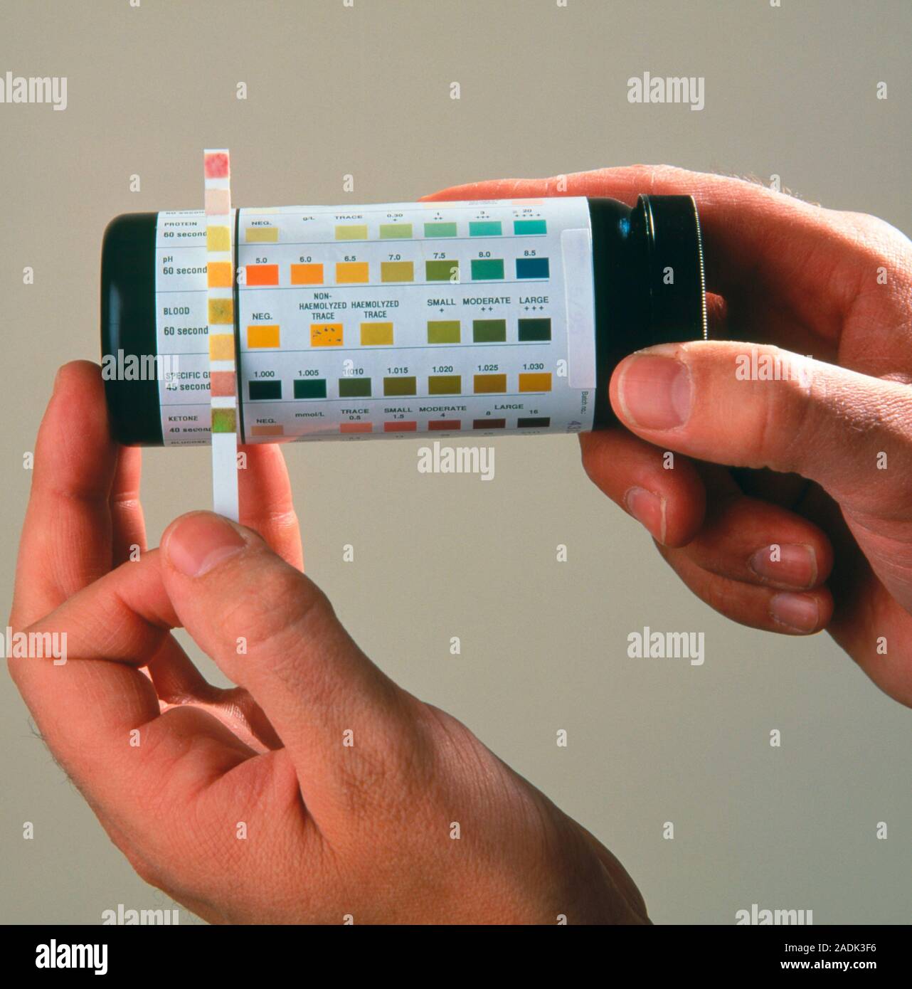 Urine Analysis General Practice Doctors Hands Hold Up A Multiple Test Stick Dipped In Urine