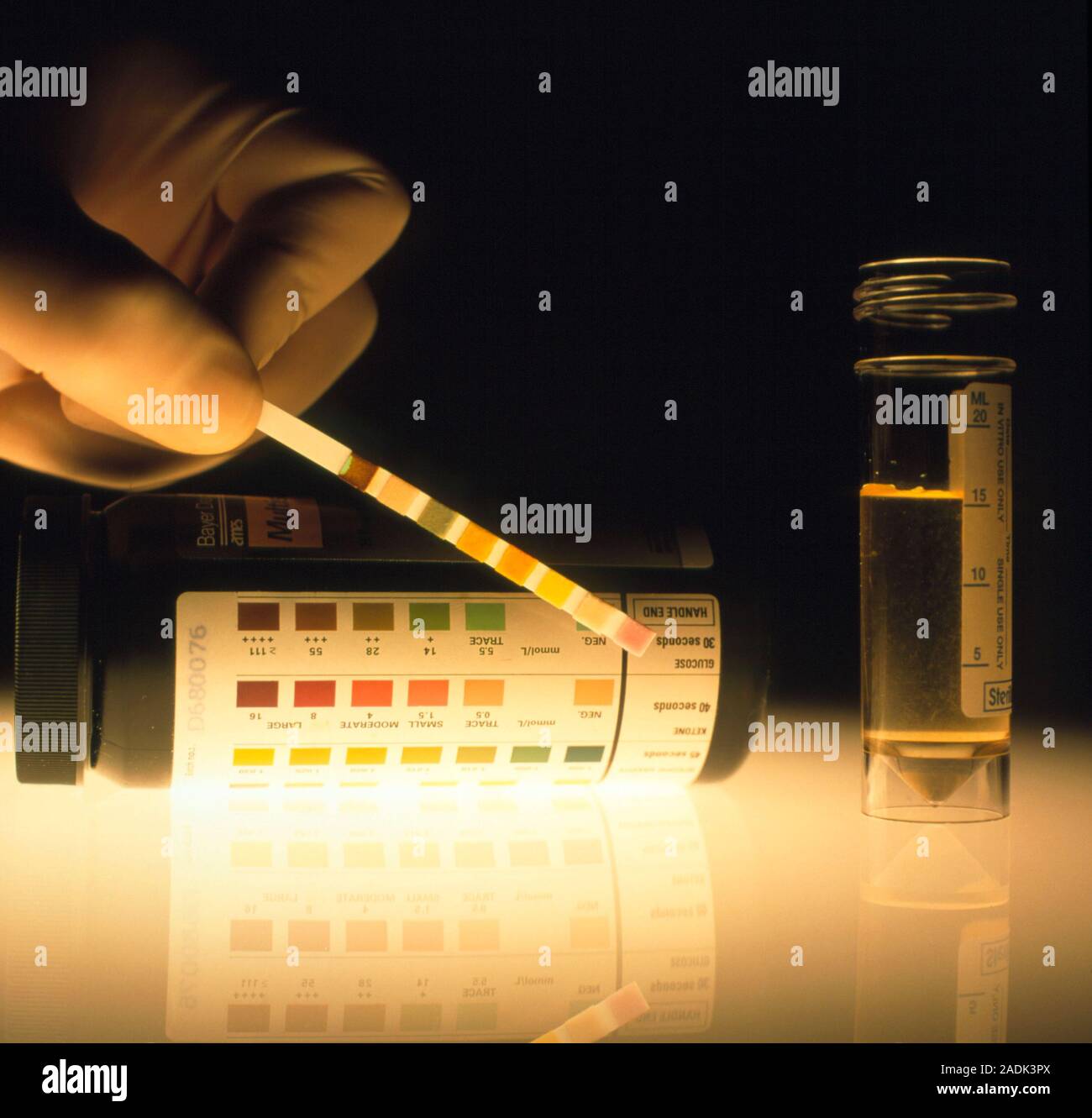 Urine analysis. Gloved hand holding a multiple test stick dipped in ...