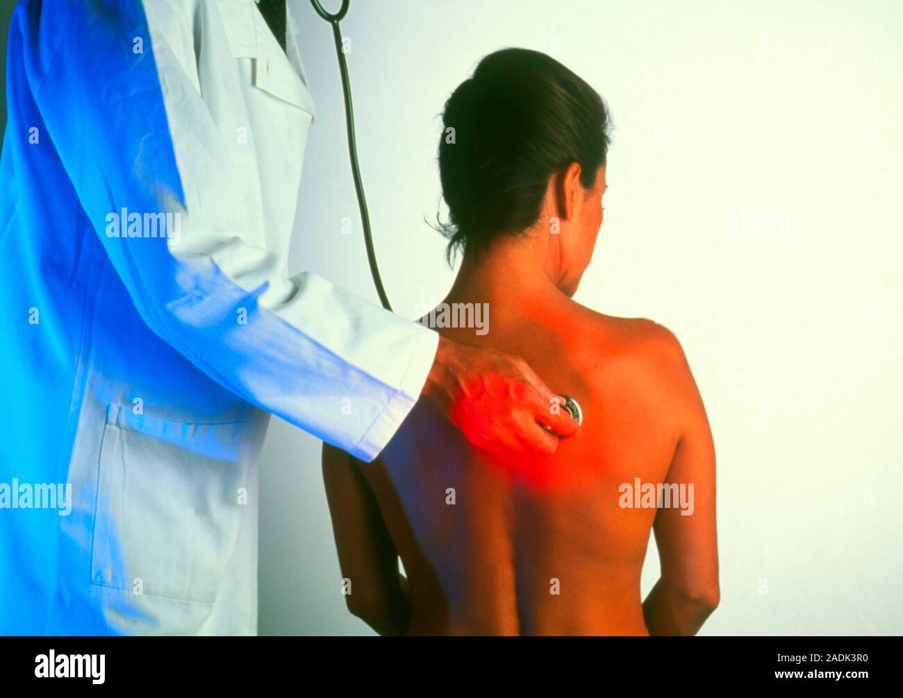 Lung examination. General practice doctor listening to the lungs of a ...