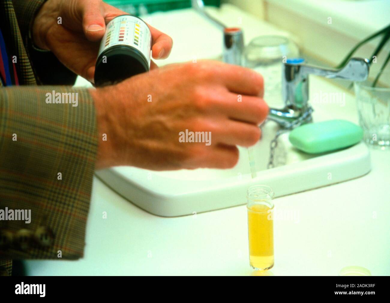 Urine analysis. Doctor dipping a urine test stick in a vial of urine ...