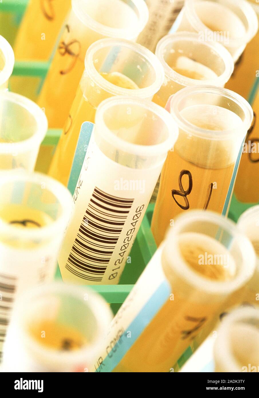 Urine samples. Bar coded tubes containing urine for testing. Urine may ...
